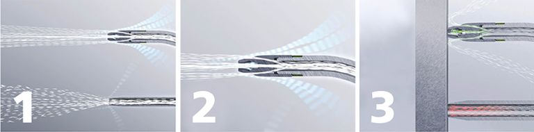 Why Silvent? Lower the sound level | Save energy | Work safe | Silvent